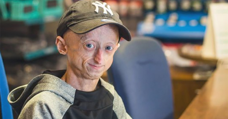 Nieuw medicijn verlengt leven progeriapatiënt Michiel met 2 jaar | Foto ...