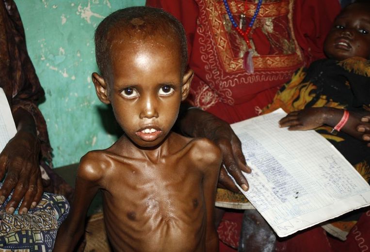 500.000 kinderen bedreigd met hongerdood in Oost-Afrika | Wetenschap ...