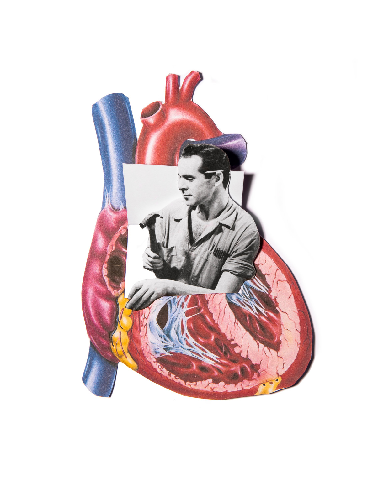 Na een hartoperatie kun je binnen een dag thuis zijn | De Volkskrant