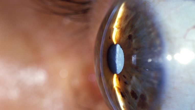 Artsen laten ogen zichzelf helen | De Volkskrant